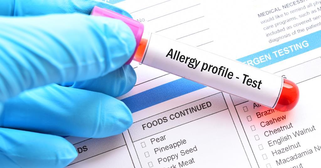 FSA looks to standardise allergen labelling to improve consumer ...